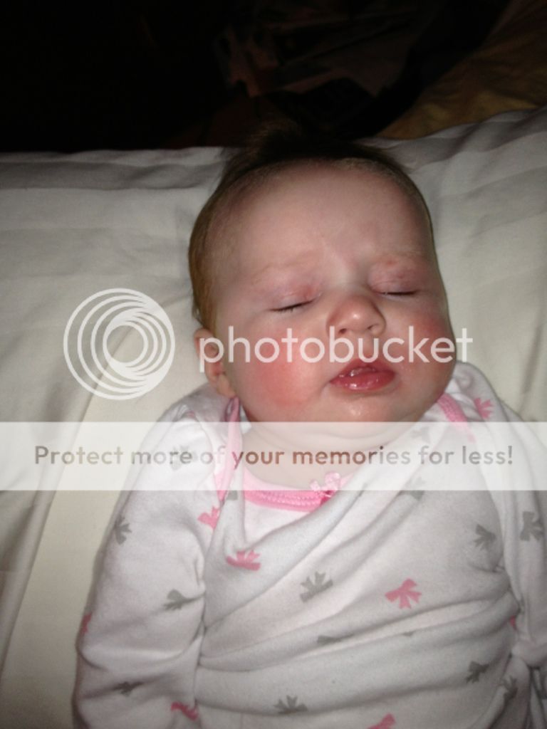 slap cheek disease or teething? pic incl | BabyCenter